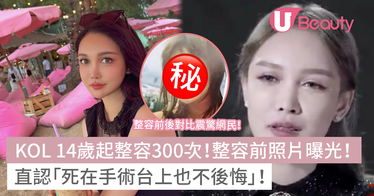 KOL 14歲起整容300次！整容前照片曝光震驚網民！直認「死在手術台上也不後悔」！ | U Beauty