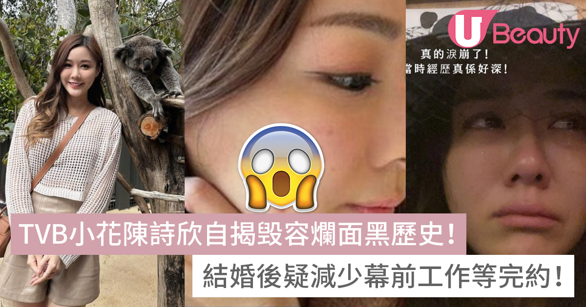 TVB小花陳詩欣自揭毁容爛面黑歷史！結婚後疑減少幕前工作等完約！ | U Beauty
