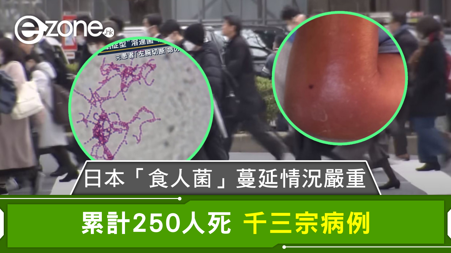 日本「食人菌」疫情嚴峻！死亡人數破250 病例數創新高 | ezone