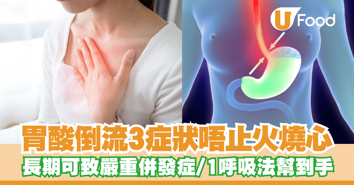 胃酸倒流3症狀唔止火燒心！長期可致嚴重併發症／醫生教1呼吸法幫到手 | U Food